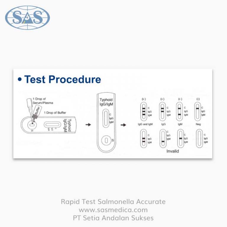 Jual Rapid Test Salmonella Typhoid IgG / IgM - Sasmedica.com